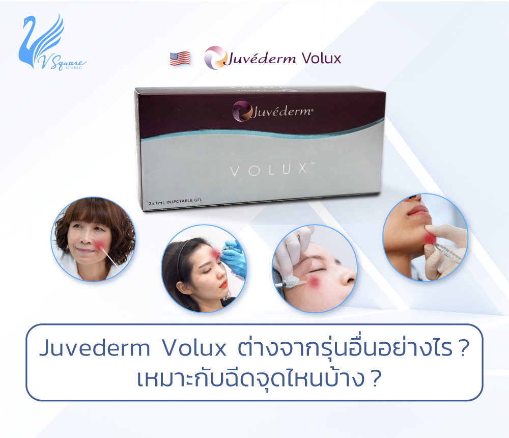 ฟิลเลอร์ juvederm Volux มีข้อดีอย่างไร เหมาะกับการฉีดจุดไหนบ้าง