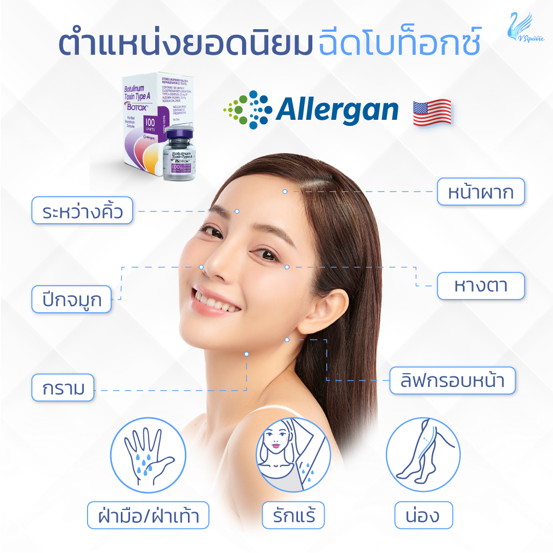 เจาะลึก Botox Allergan โบท็อกซ์สัญชาติอเมริกา ดีอย่างไร ? คุ้มค่าไหม